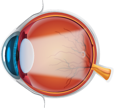 Cataract Causes, Symptoms and Treatment Minneapolis and Edina