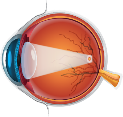 Cataract Causes, Symptoms and Treatment Minneapolis and Edina